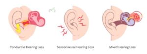 Auditory Signal Transduction - MCAT Content – MedLife Mastery